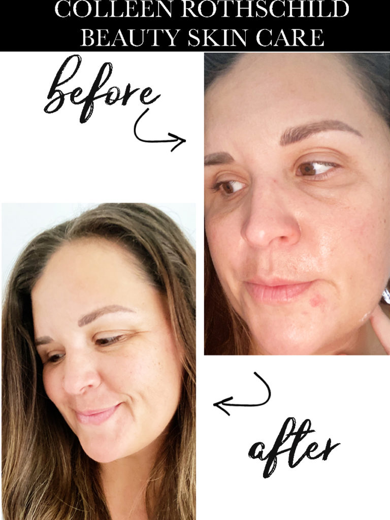 How to Start and Anti Aging Skin Care Routine With Colleen Rothschild